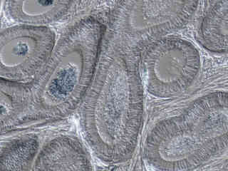 Differential Interference Contrast (DIC) | Nikon’s MicroscopyU