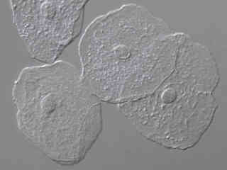 Differential Interference Contrast (DIC) | Nikon’s MicroscopyU