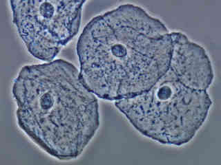 Differential Interference Contrast (DIC) | Nikon’s MicroscopyU