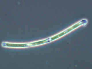 Differential Interference Contrast (DIC) | Nikon’s MicroscopyU