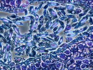 Differential Interference Contrast (DIC) | Nikon’s MicroscopyU