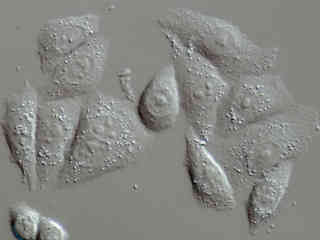 Differential Interference Contrast (DIC) | Nikon’s MicroscopyU