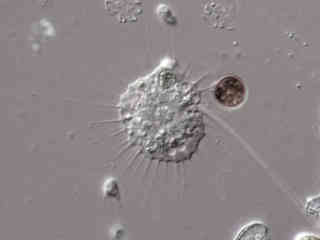Differential Interference Contrast (DIC) | Nikon’s MicroscopyU