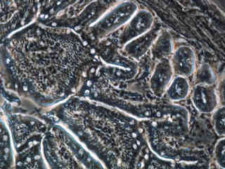 Differential Interference Contrast (DIC) | Nikon’s MicroscopyU