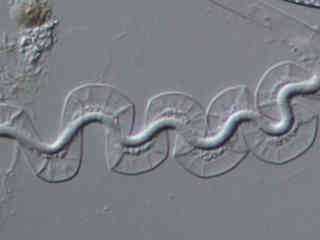 Differential Interference Contrast (DIC) | Nikon’s MicroscopyU