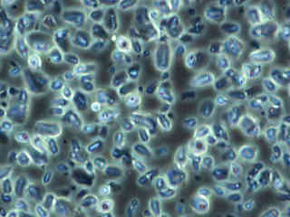 Phase Contrast | Nikon’s MicroscopyU