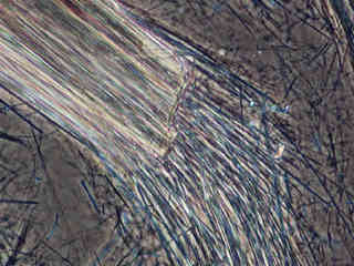 Phase Contrast | Nikon’s MicroscopyU