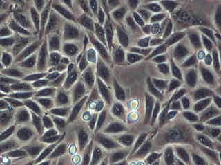 Phase Contrast | Nikon’s MicroscopyU
