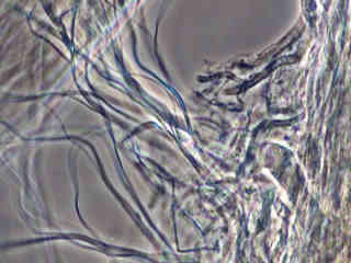 Phase Contrast | Nikon’s MicroscopyU