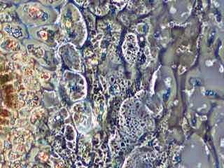 Phase Contrast | Nikon’s MicroscopyU