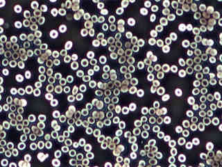 Phase Contrast | Nikon’s MicroscopyU