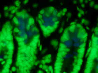 Dual Band Excitation: DAPI-FITC | Nikon’s MicroscopyU
