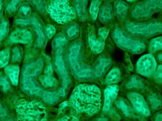 Dual Band Excitation: DAPI-FITC | Nikon’s MicroscopyU