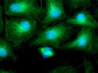 Dual Band Excitation: DAPI-FITC | Nikon’s MicroscopyU