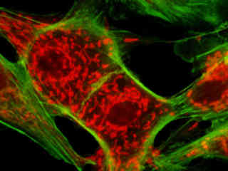 Dual Band Excitation: FITC-Texas Red | Nikon’s MicroscopyU