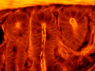 Green Excitation: Cy3 HYQ (Bandpass Emission) | Nikon’s MicroscopyU