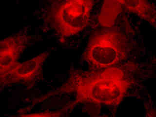 Red Excitation: Cy5 HYQ (Bandpass Emission) | Nikon’s MicroscopyU