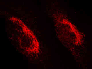 Red Excitation: Cy5 HYQ (Bandpass Emission) | Nikon’s MicroscopyU