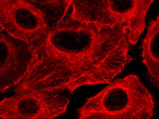 Red Excitation: Cy5 HYQ (Bandpass Emission) | Nikon’s MicroscopyU