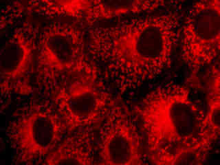 Red Excitation: Cy5 HYQ (Bandpass Emission) | Nikon’s MicroscopyU