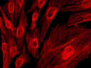 Red Excitation: Cy5 HYQ (Bandpass Emission) | Nikon’s MicroscopyU