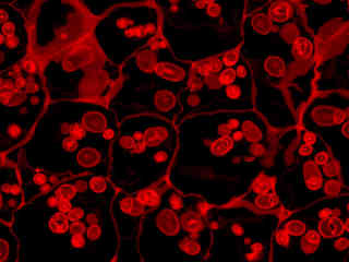 Red Excitation: Cy5 HYQ (Bandpass Emission) | Nikon’s MicroscopyU