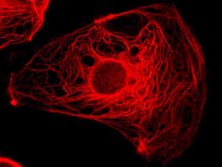 Red Excitation: Cy5 HYQ (Bandpass Emission) | Nikon’s MicroscopyU