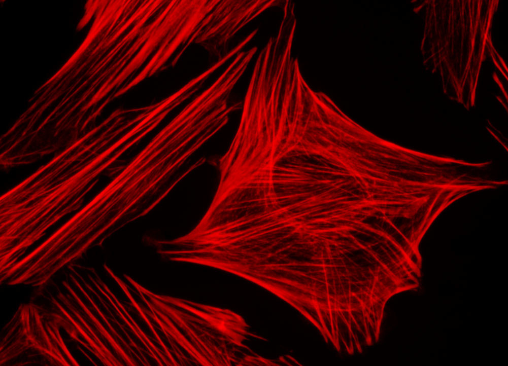 Indian Muntjac Actin Cytoskeleton | Nikon’s MicroscopyU