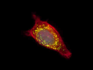 Triple Band Excitation: DAPI-FITC-Texas Red | Nikon’s MicroscopyU