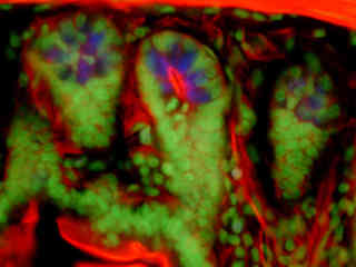 Triple Band Excitation: DAPI-FITC-Texas Red | Nikon’s MicroscopyU