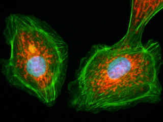 Triple Band Excitation: DAPI-FITC-Texas Red | Nikon’s MicroscopyU