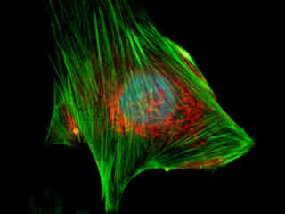 Triple Band Excitation: DAPI-FITC-Texas Red | Nikon’s MicroscopyU