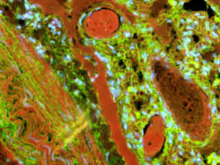 Triple Band Excitation: DAPI-FITC-Texas Red | Nikon’s MicroscopyU