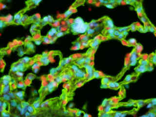 Triple Band Excitation: DAPI-FITC-Texas Red | Nikon’s MicroscopyU