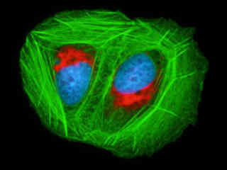 Triple Band Excitation: DAPI-FITC-Texas Red | Nikon’s MicroscopyU