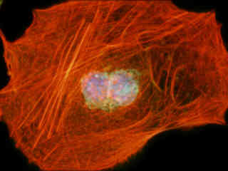 Triple Band Excitation: DAPI-FITC-TRITC | Nikon’s MicroscopyU
