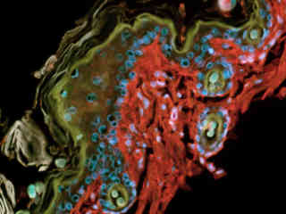 Triple Band Excitation: DAPI-FITC-TRITC | MicroscopyU