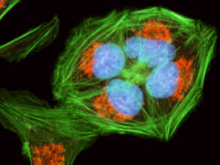 Triple Band Excitation: DAPI-FITC-TRITC | Nikon’s MicroscopyU