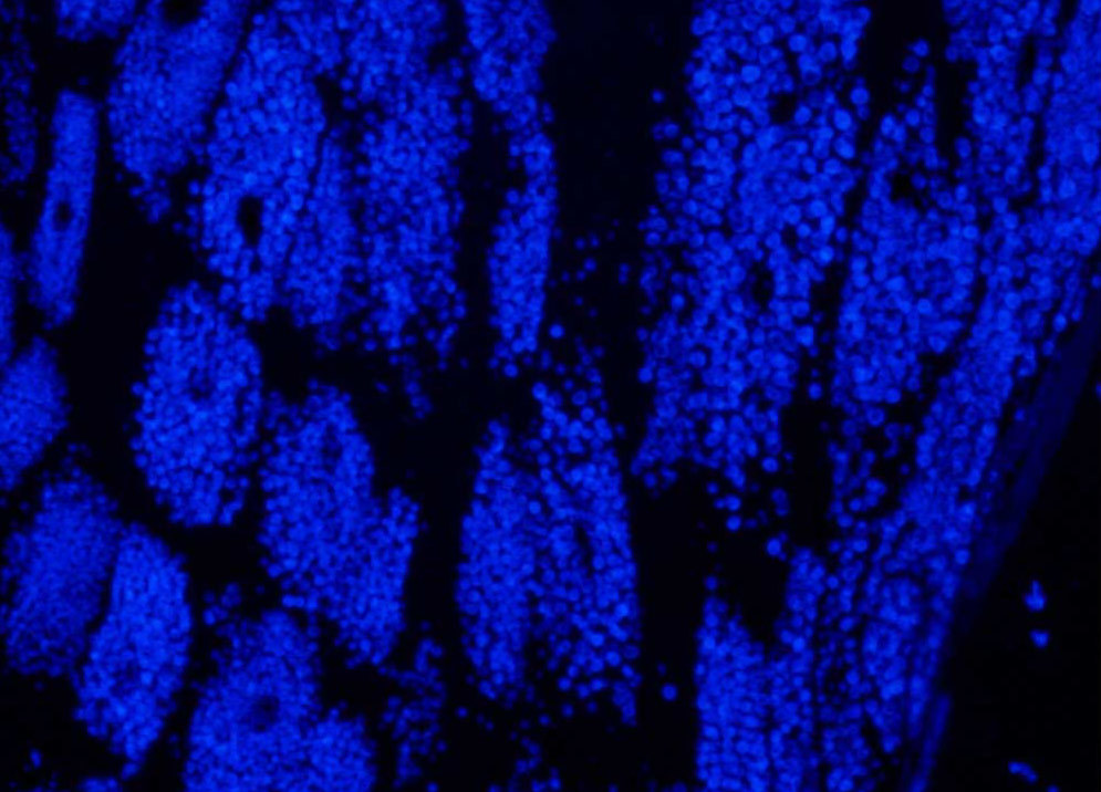 Corn Grain Thin Section | Nikon’s MicroscopyU