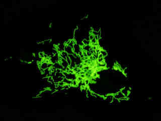 Enhanced Yellow Fluorescent Protein (EYFP) Mitochondria Localization ...
