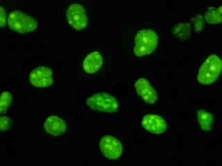 Enhanced Yellow Fluorescent Protein (EYFP) Nuclear Localization | Nikon ...