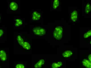 Enhanced Yellow Fluorescent Protein (EYFP) Nuclear Localization | Nikon ...