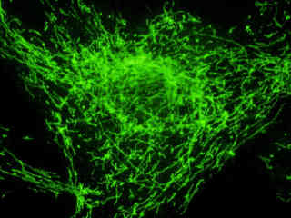 Yellow Fluorescent Protein Excitation: YFP HYQ | Nikon’s MicroscopyU