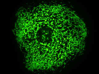 Yellow Fluorescent Protein Excitation: YFP HYQ | Nikon’s MicroscopyU