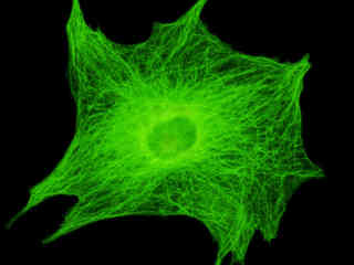 Yellow Fluorescent Protein Excitation: YFP HYQ | Nikon’s MicroscopyU