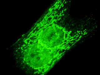 Yellow Fluorescent Protein Excitation: YFP HYQ | Nikon’s MicroscopyU