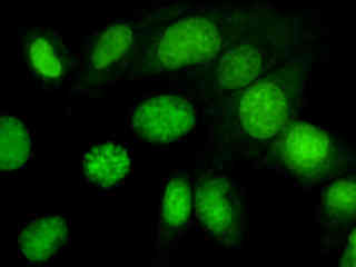 Yellow Fluorescent Protein Excitation: YFP HYQ | Nikon’s MicroscopyU