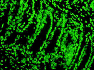 Yellow Fluorescent Protein Excitation: YFP HYQ | Nikon’s MicroscopyU