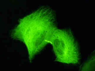Enhanced Yellow Fluorescent Protein (EYFP) Tubulin Localization | Nikon ...