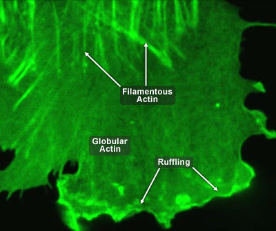 Fox Lung Fibroblast Cells Expressing EGFP fused to Actin | Nikon’s ...
